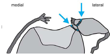Lesiones de la Rodilla - Luxación de Rótula | Centro Médico Interlomas ...