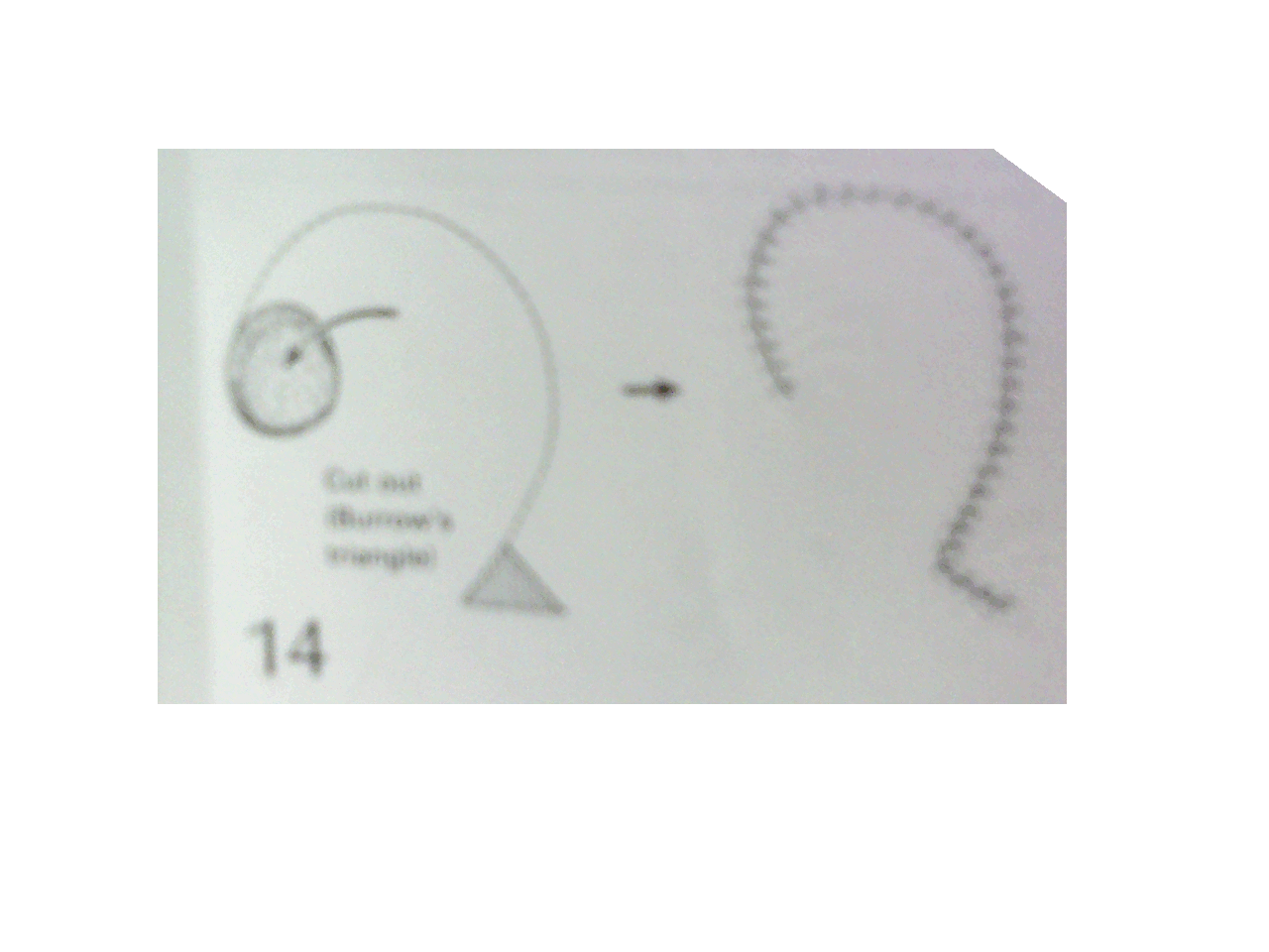 Basic Surgical Principles - @364