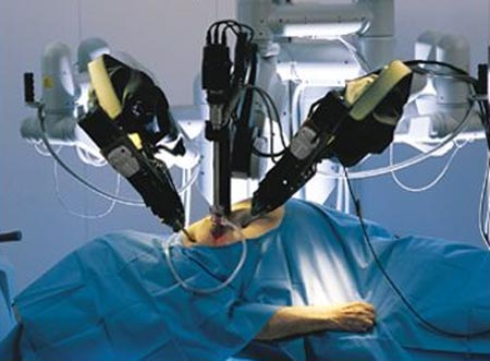 Operasi dengan menggunakan Robot (Robotic Surgery) ~ Blognya Orang Ganteng