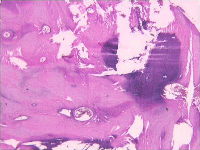 HistoloBlog: It's artifactual