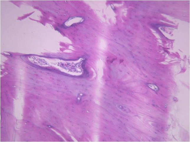 HistoloBlog: It's artifactual