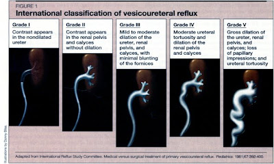 PG Medic: Hydronephrosis