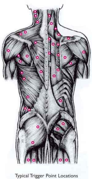 South Charlotte Massage: What is the Neuromuscular Therapeutic Massage?