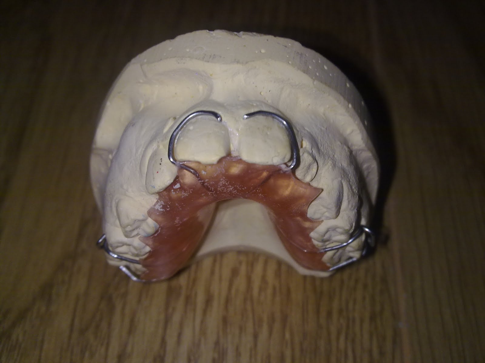 My Jaw Surgery Diary: Intro