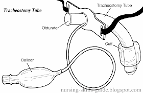 Nursing Skills Guide: Trachostomy Tube