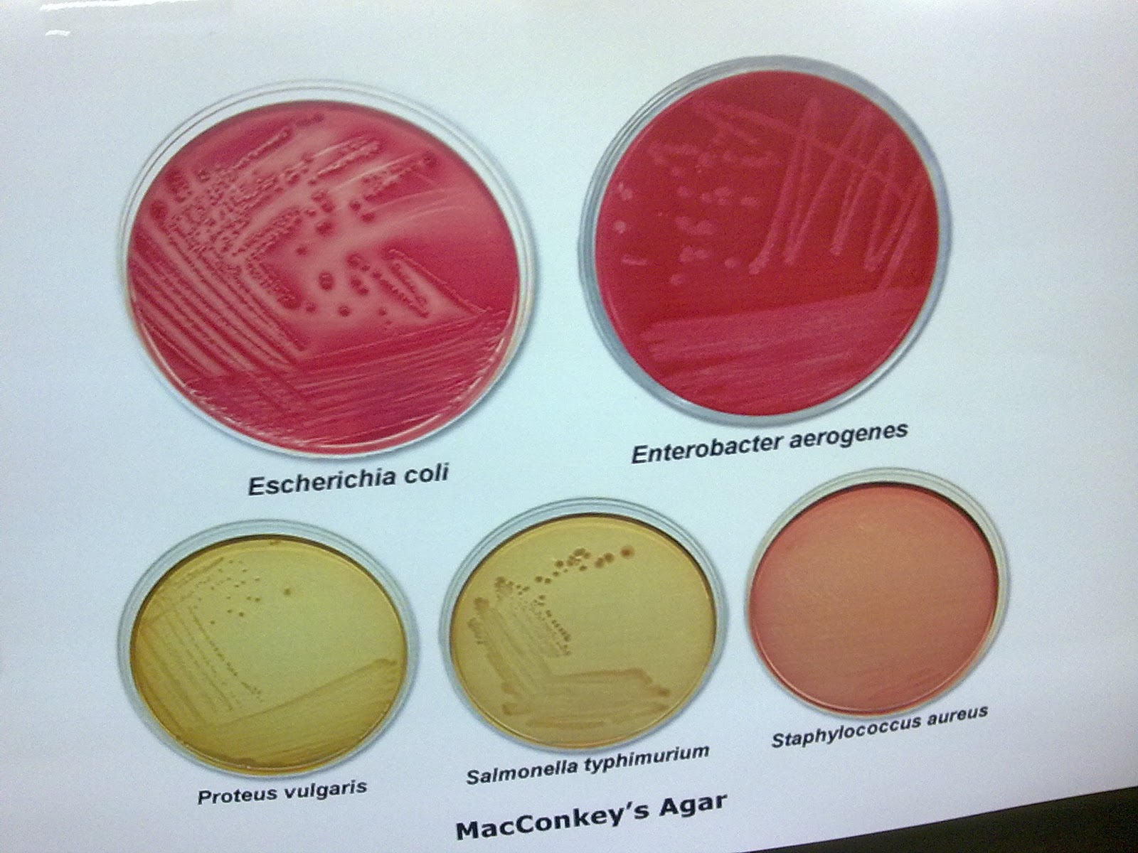 HARPACTIRINAE BIOTECHNOLOGY: Microbes Theoretical result `~~~part 1