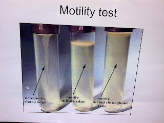 HARPACTIRINAE BIOTECHNOLOGY: Microbes Theoretical result ~~~part 2