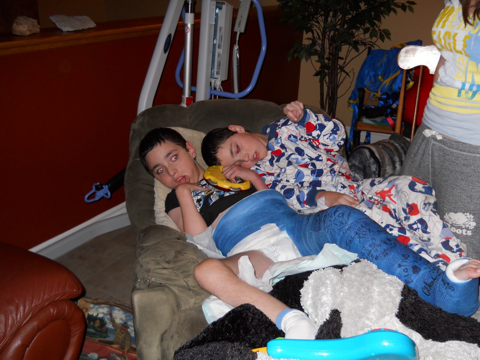 Parent Connect: The joys of a spica cast