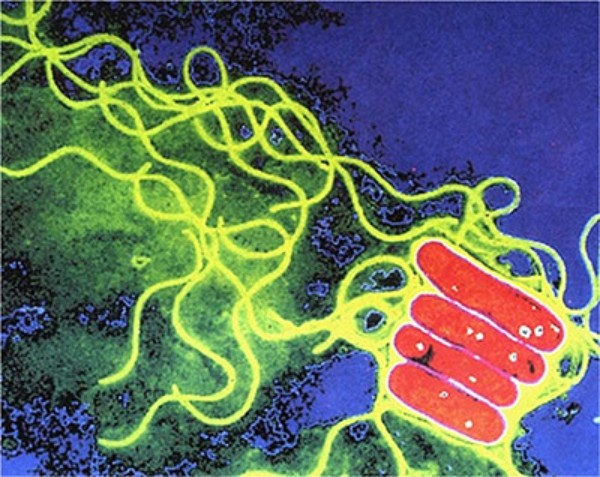 SALUD Y MEDICINA: La Legionelosis