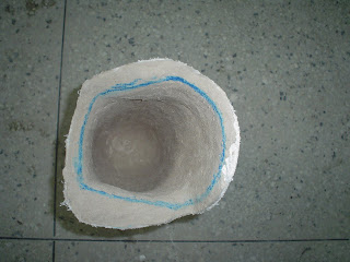 Prosthetics and Orthotics Village: Transfermoral sockets in different view.