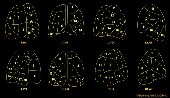 Roentgen Ray Reader Lung Segments For Vq Scans