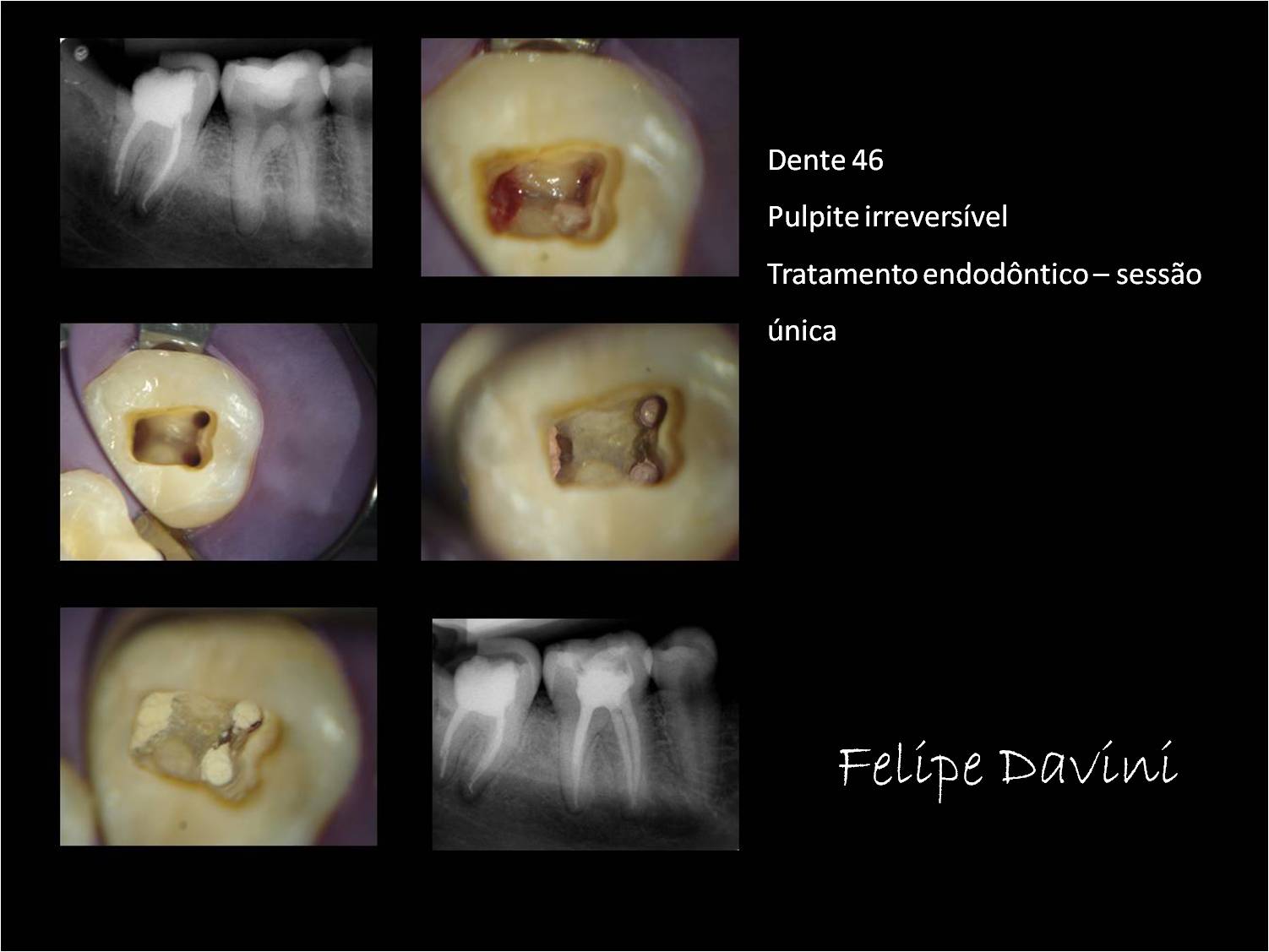 Anatomia Do Dente 46 - RETOEDU