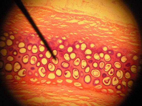 Histologia y Embriologia: ATLAS: TEJIDO CARTILAGINOSO