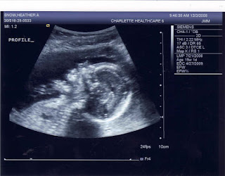 Introducing... Connor William Rozar!: 19 Weeks - 3D Ultrasound