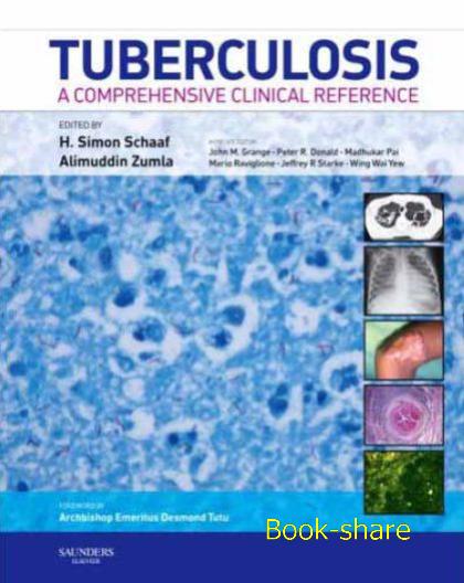 E-book: Tuberculosis: A Comprehensive Clinical Reference by H. Simon Schaaf
