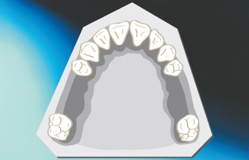 P D L: Partially Edentulous Conditions