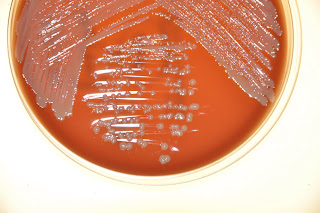 FOTOGRAFIAS DE JDOURADO: Staphylococcus haemolyticus
