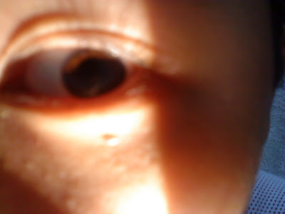 Optometry-More than what meets the eye.: About ''PERRLA''