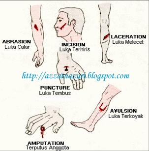 azzatnazuri.blogspot.com: Luka&Pendarahan