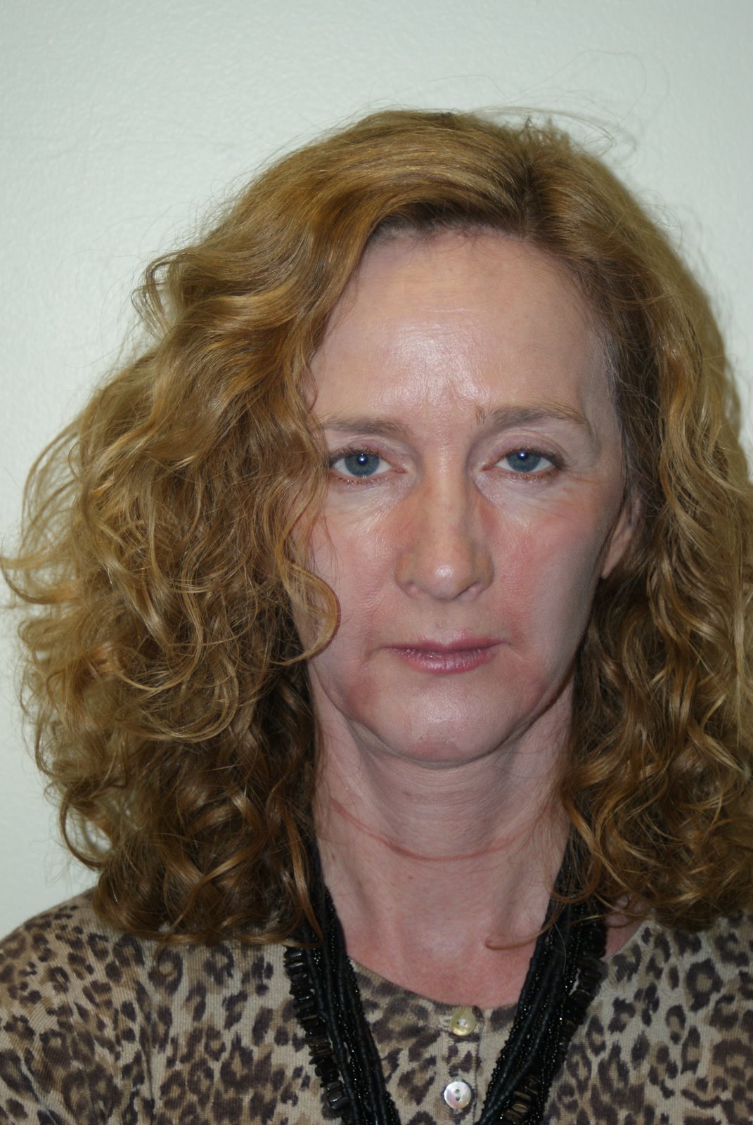 Solihull College Theatrical Make-up Course: Emaciation and Obesity ...