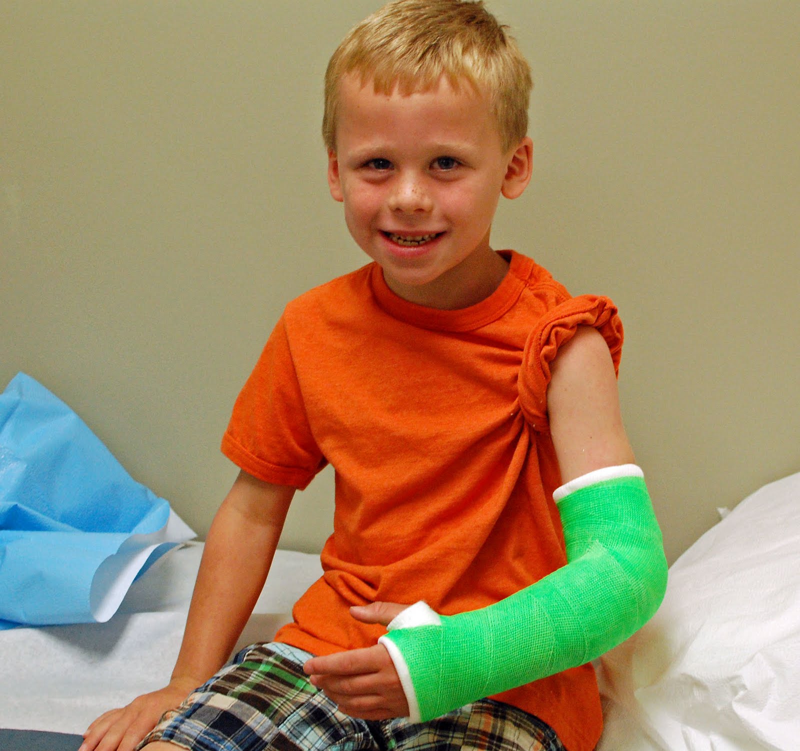 Green Arm Cast