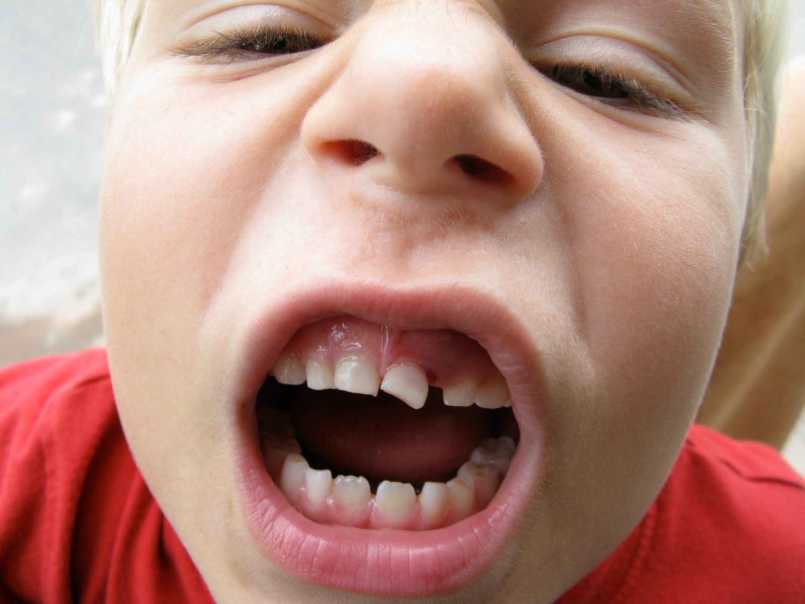 Annika and Auggie move to India: August's loose tooth