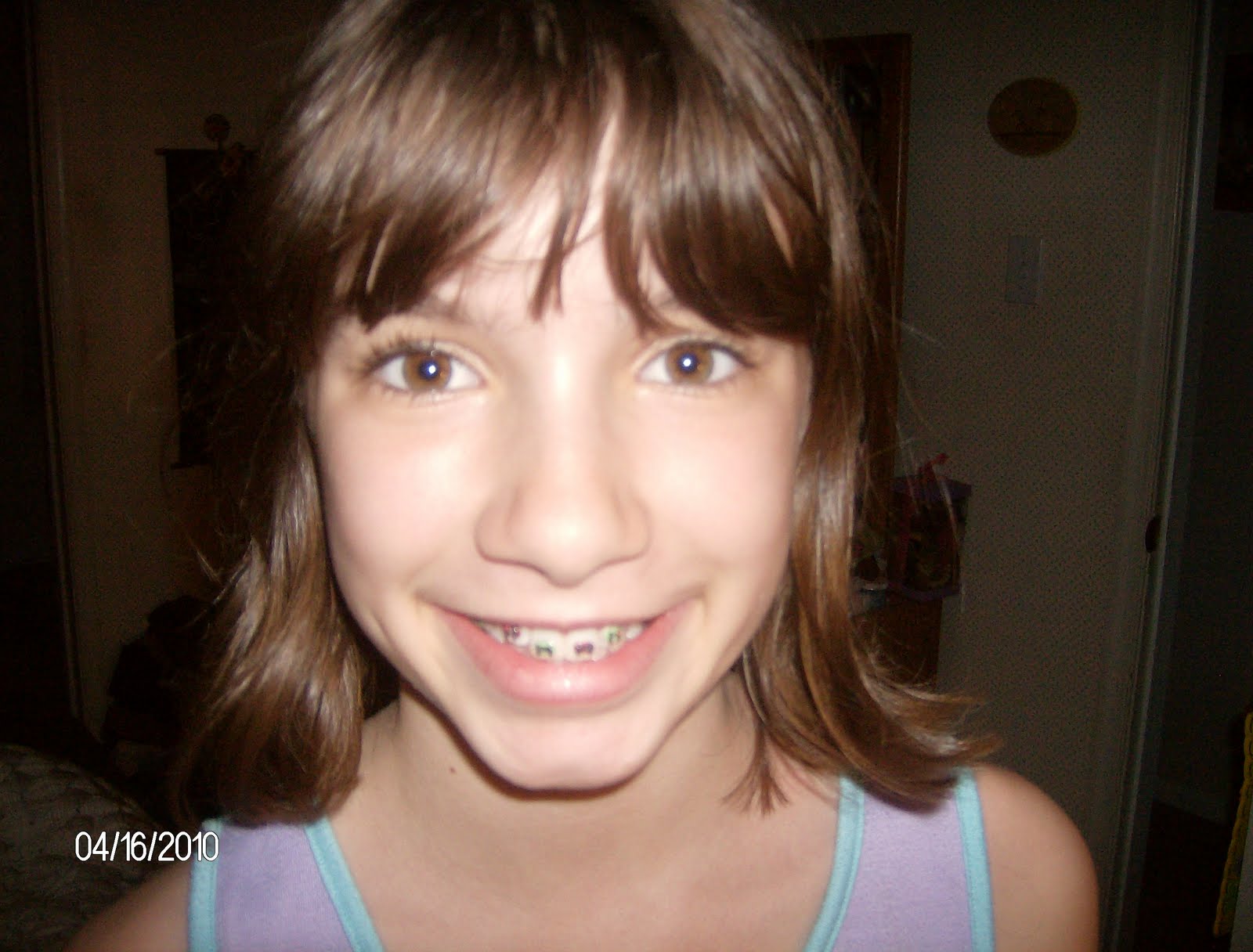 Connect With The Kanes Braces For Joceline