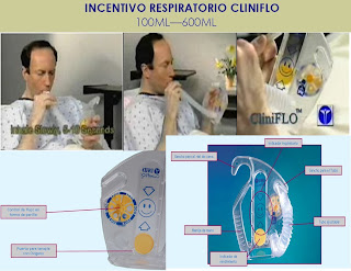 TIENDA DEL CUIDADO RESPIRATORIO: EQUIPOS PARA REHABILITACIÓN PULMONAR