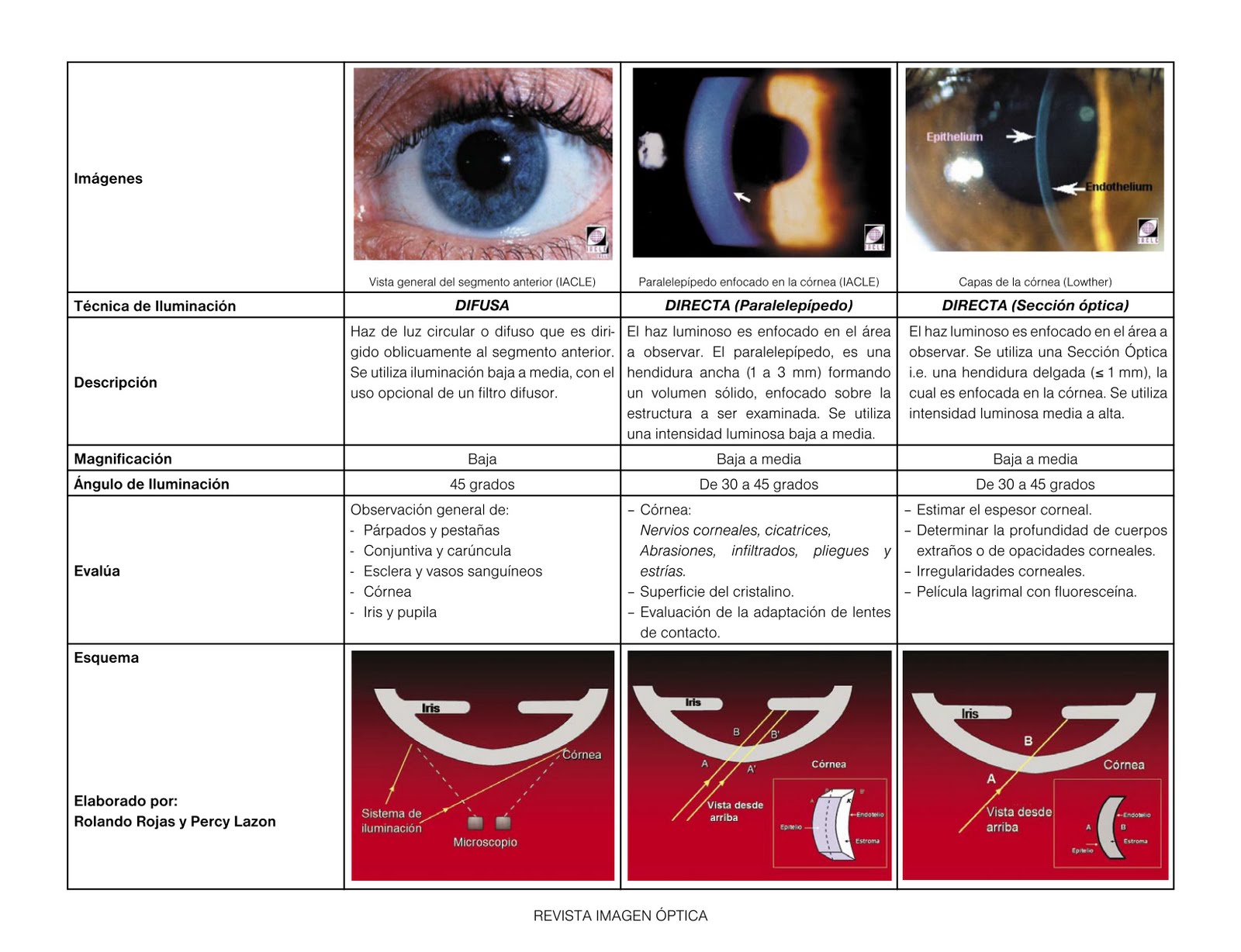 TM Oftalmología: Tabla de Biomicroscopía
