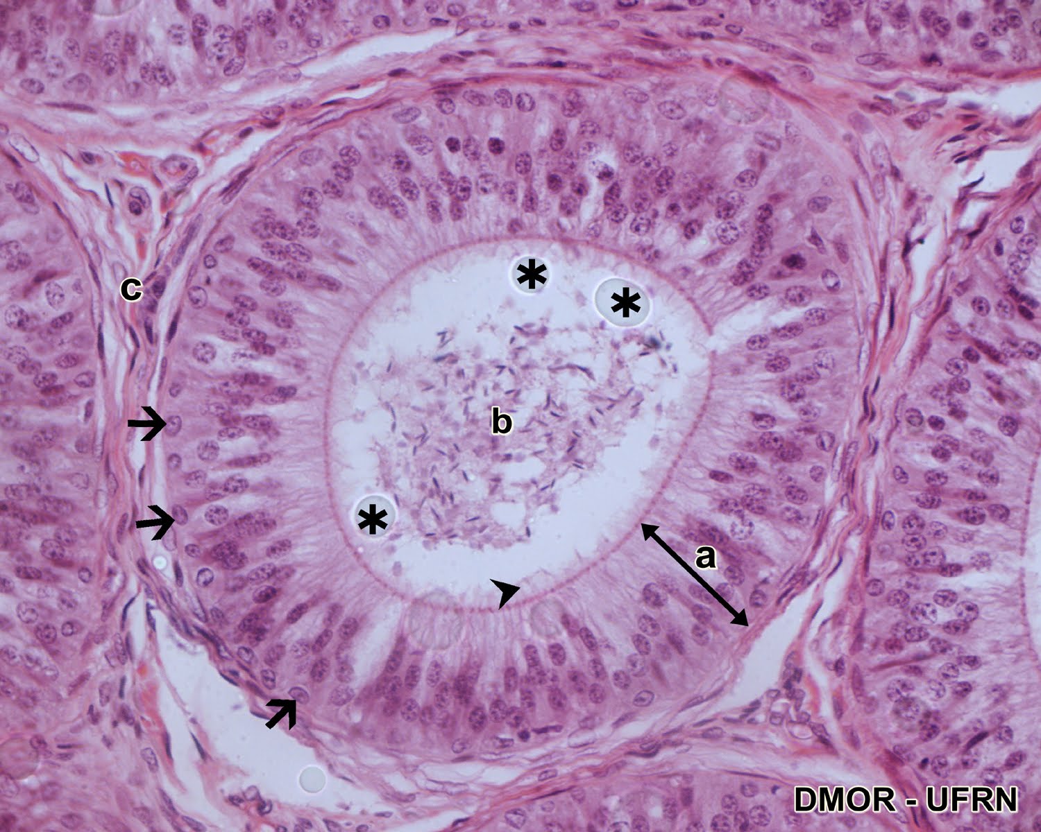 Ciências Morfológicas - UFRN: Sistema Reprodutor Masculino