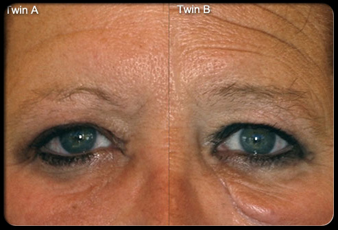 HEALTH & DISEASE: How Smoking Affects Your Looks and Life