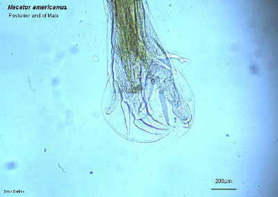 Necator Americanus Macho