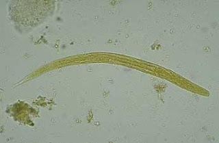 Parasitologia: Nematoda. Familias Ancylostomidae e Strongiloididae.