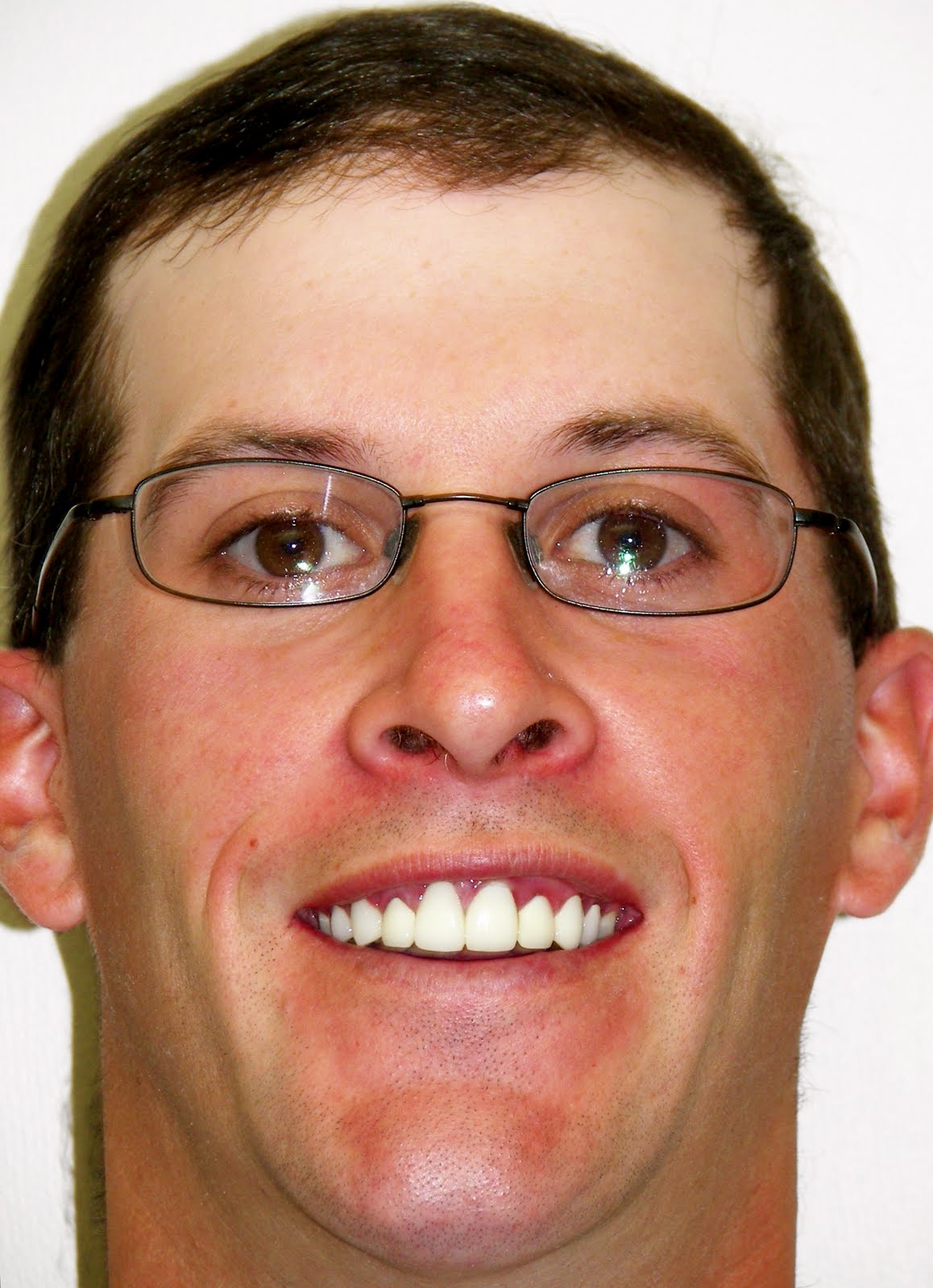 Dental Reflections Blog: Dr.Kaloti Extreme Dental Makeover Winner ...