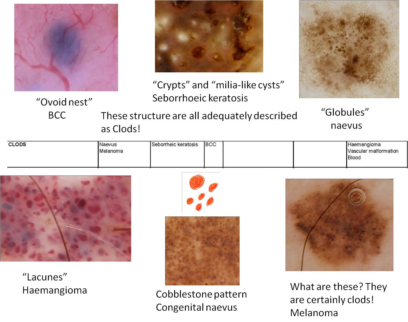 Introduction to Dermatoscopy
