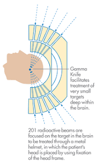 BIO-MEDICAL ENGINEERING: Gamma Knife