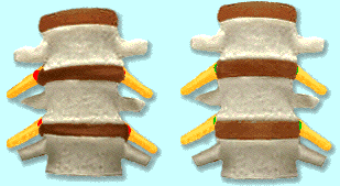 Dr. Evan Price Chiropractic Scottsdale, Az.: Defining a Healthy Spine ...