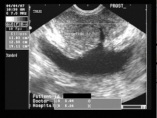 Latest Innovations In Medicine: Diagnostic Evaluation of Prostate ...