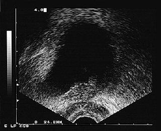 Latest Innovations In Medicine: Diagnostic Evaluation of Prostate ...