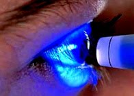 Belle Clinique: Tonometria de Aplanação de Goldmann