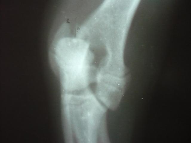 CLÍNICA VETERINARIA (NORTON) DR. MARCELO CANDO : FRACTURA ASPECTO ...