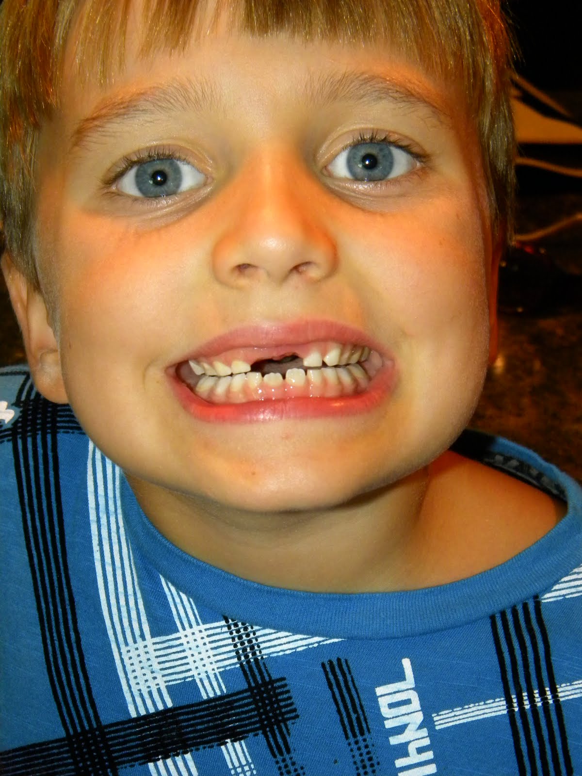 my blue eyed boys: another tooth lost....