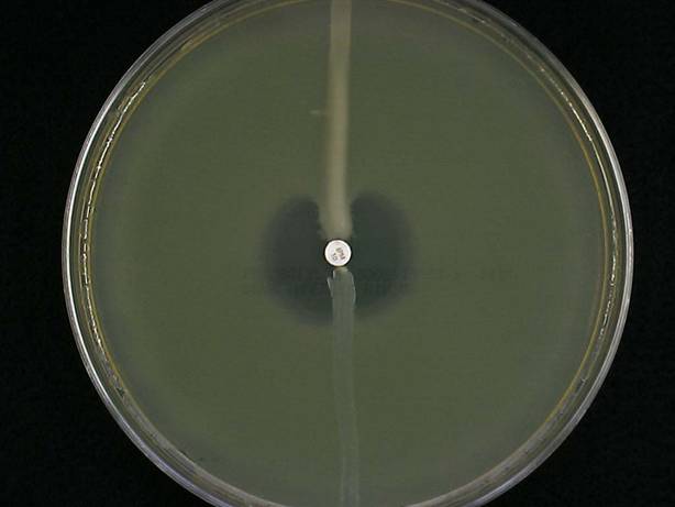 Resistência Bacteriana: Diagnóstico Laboratorial das KPC - Parte II "O ...