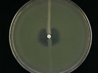Resistência Bacteriana: Diagnóstico Laboratorial das KPC - Parte II "O ...