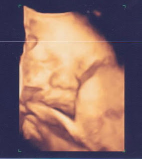 we can dig it: 39 week ultrasound