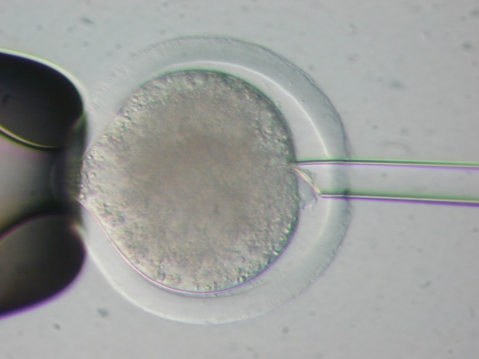 La Transgenesis: Transgenesis y ingenieria genetica