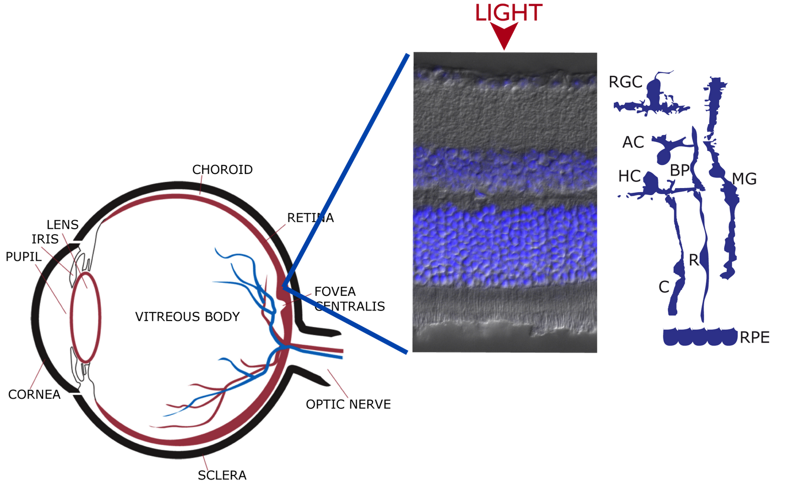 (PDF) Sensory stimulation for lowering intraocular pressure, improving ...