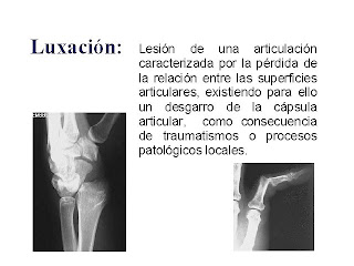 Kenpo Salud: Luxaciones