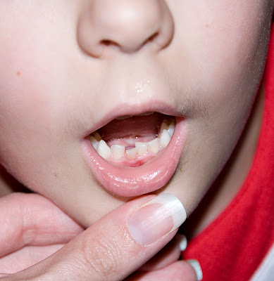 Fry Moments: July 2010