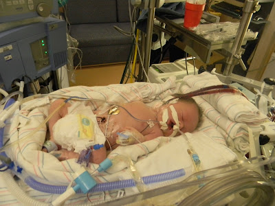 The Greer Family: Going on ECMO